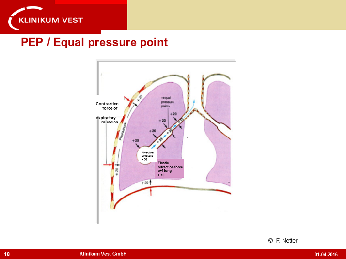 PEP / Equal Pressure Point - Airway Secretion and Clearance in COPD - Activity Three: COPD ...