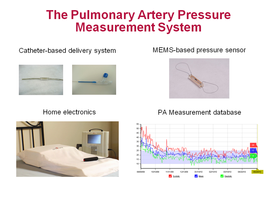 Hemodynamic Monitoring for Heart Failure Patients