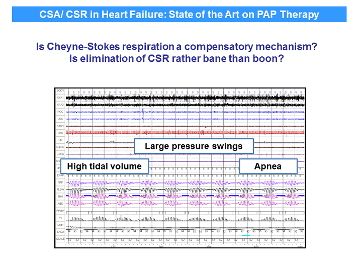 Is Cheyne-Stokes Respiration a Compensatory Mechanism? Is Elimination ...