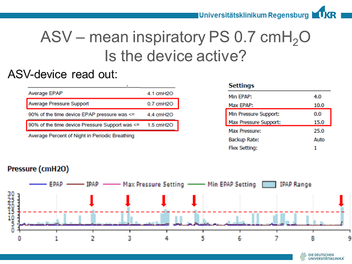 ASV - Device Read Out - Technology of Servo Ventilation - Activity ...