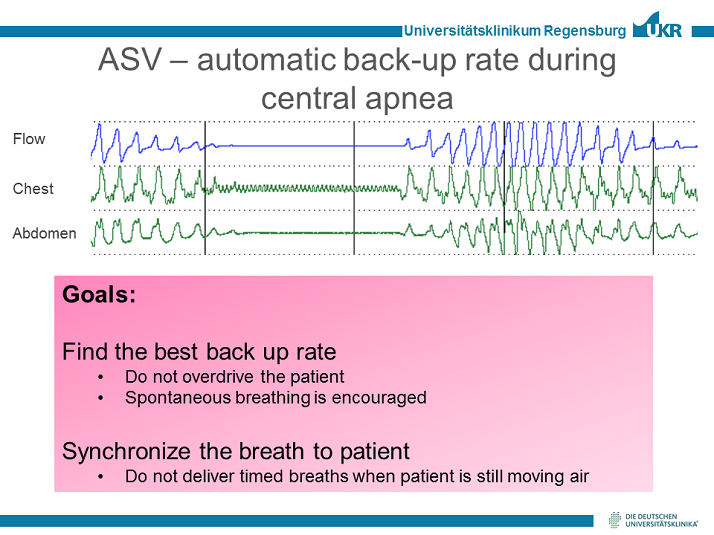 Find the best back up rate and Synchronize the breath to patient ...