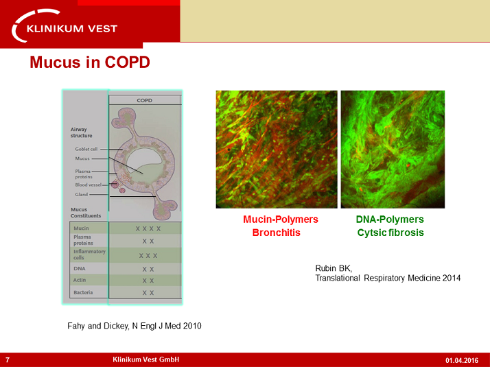 Mucus in COPD - Airway Secretion and Clearance in COPD - Activity Three ...