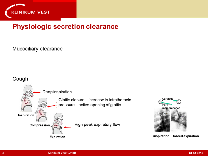 Physiology Secretion Clearance - Airway Secretion and Clearance in COPD ...