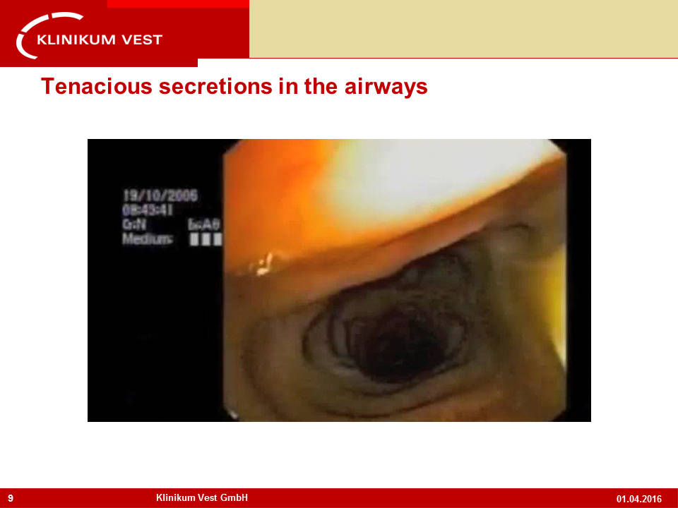 Activity Three:COPD Advanced Patient Management: Post Acute Care ...