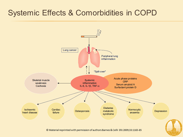 Systemic Effects & Comorbidities in COPd - Comorbidities in COPD - GOLD ...