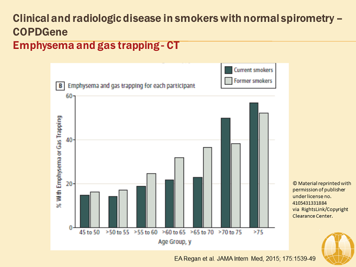 Emphysema and Gas Trapping - CT - Definition and Overview of COPD ...