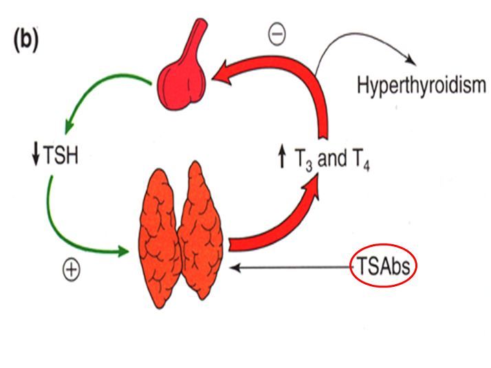 TSH Receptor Antibodies: Nomenclature, Functionality and Assay Comparison