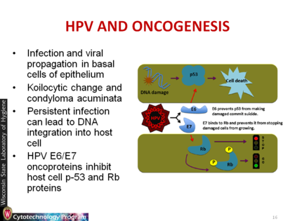 HPV and Oncogenesis - - Cervical Cancer & HPV Testing: How We Got Here