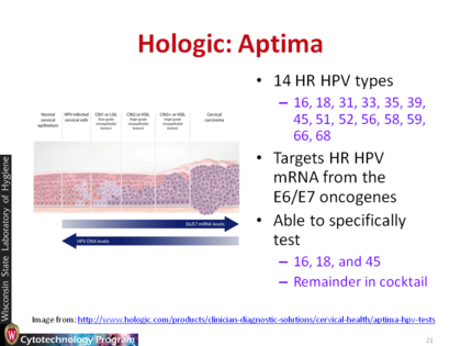 Hologic: Aptima - - Cervical Cancer & HPV Testing: How We Got Here