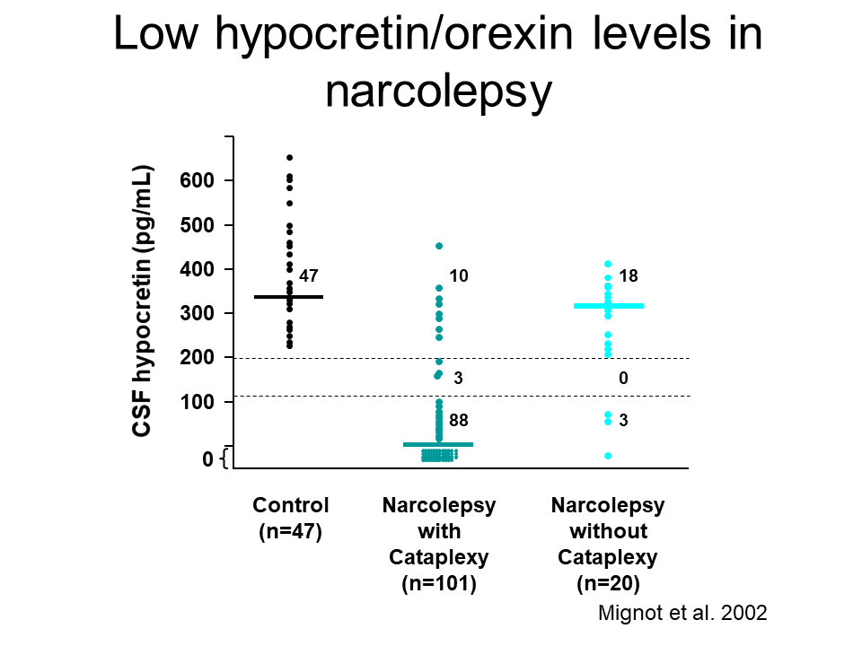 Narcolepsy Hypocretin