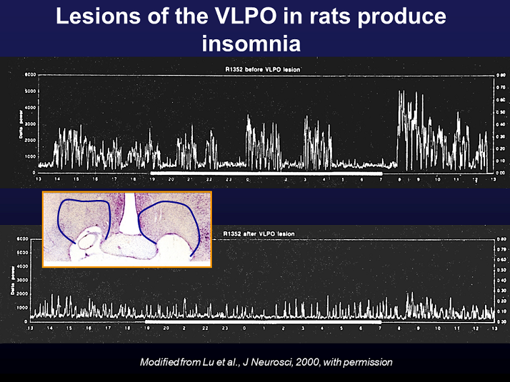 Educational Centre:Recognition of Sleep Quality, Sleep Disorders and ...