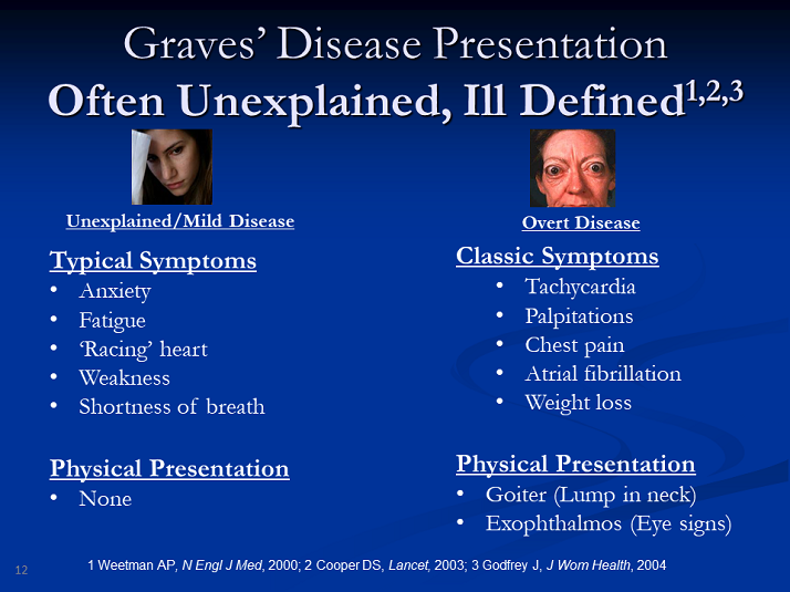 Graves’ Disease Presentation Often Unexplained, Ill Defined 1,2,3 ...