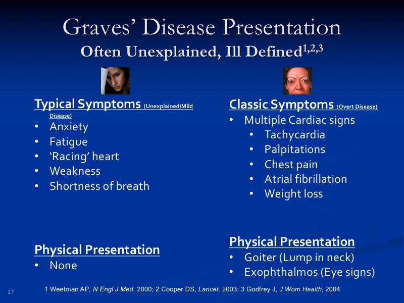 Autoimmune Thyroid Diseases