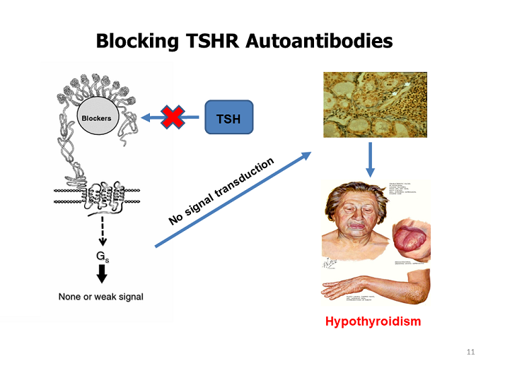 Blocking TSHR Autoantibodies - Autoantibodies to the Thyroid ...