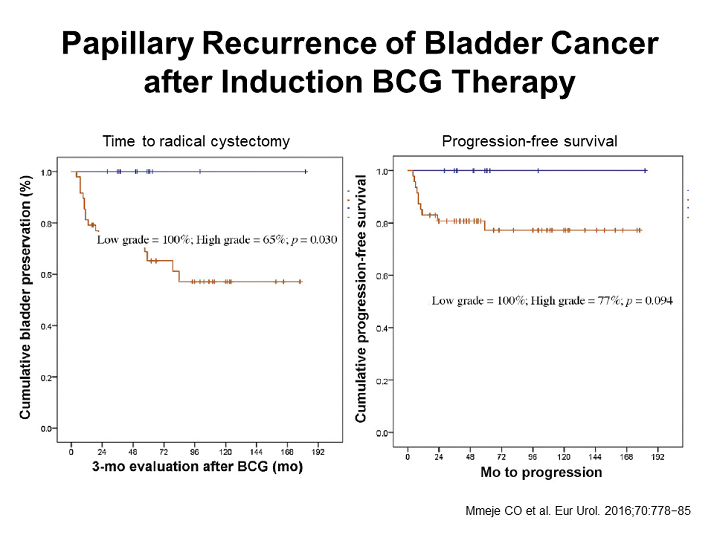 Papillary Recurrence of Bladder Cancer after Induction BCG Therapy ...