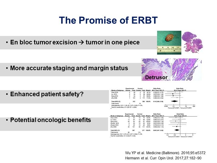 The Promise of ERBT - Activity Six: Management of T1 High-grade Bladder ...