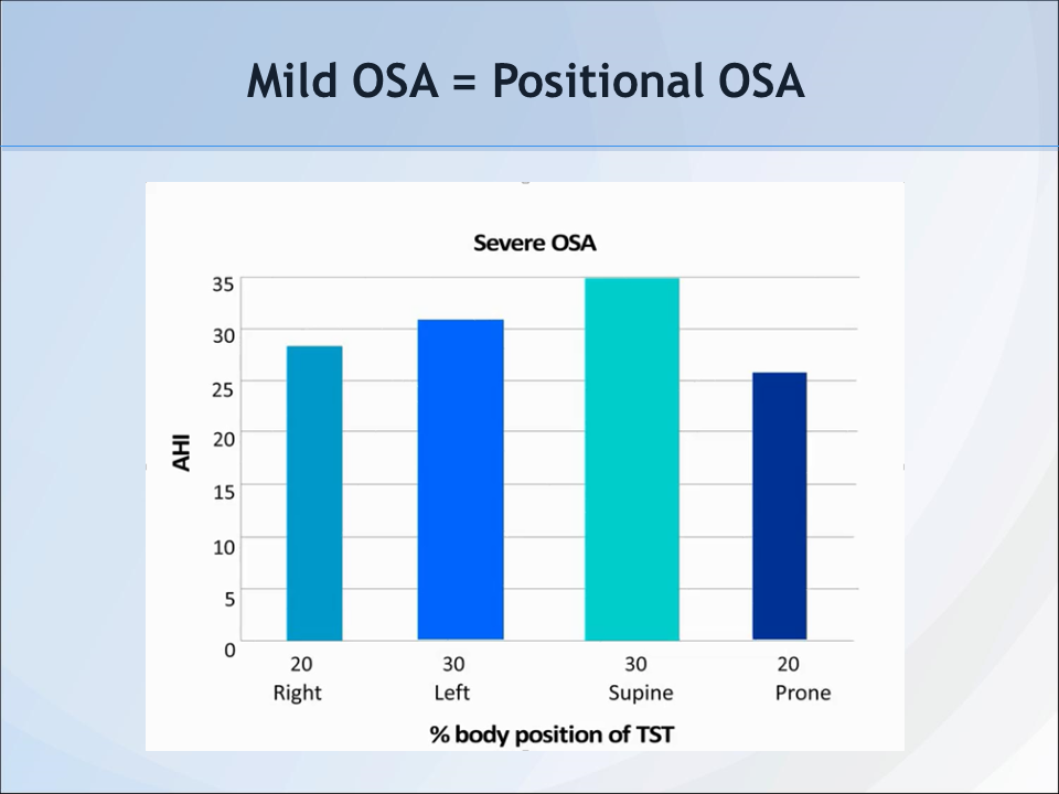 Obstructive Sleep Apnea (OSA) and Positional Obstructive Sleep Apnea (POSA)