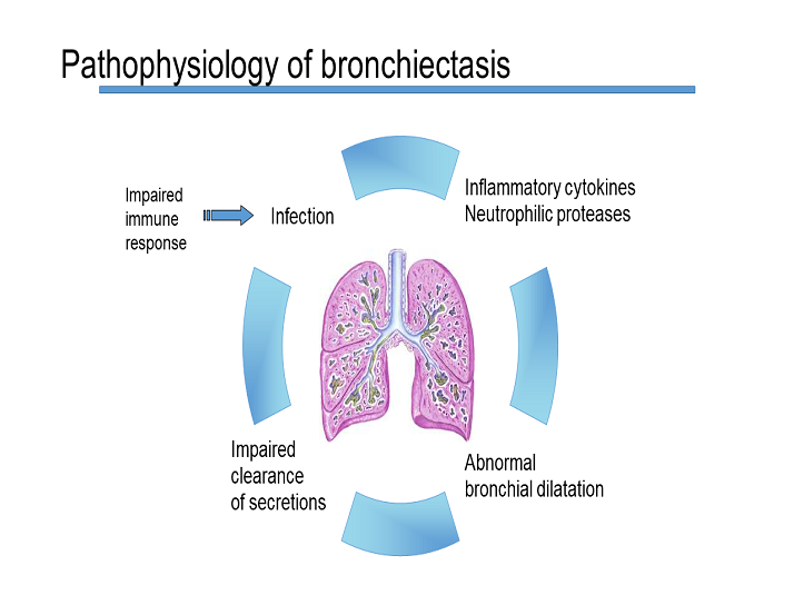 Pathophysiology of Bronchiectasis - Bronchiectasis: Diagnosis and ...