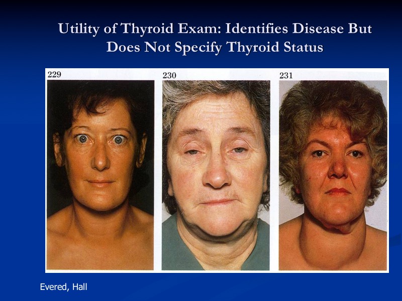 Autoimmune Thyroid Diseases