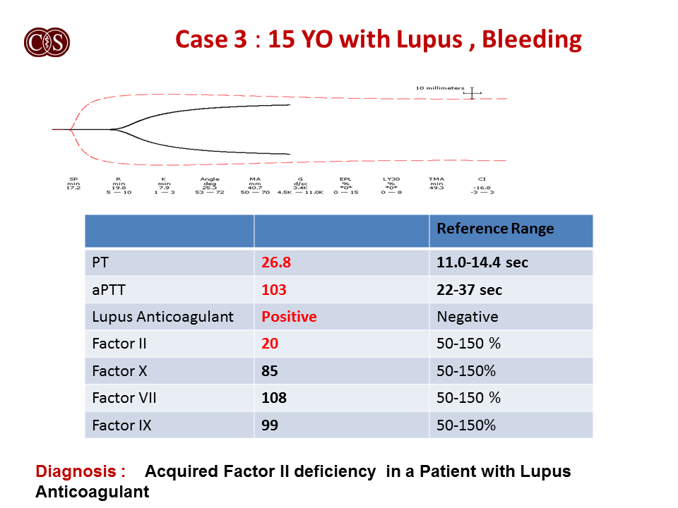 Lupus Anticoagulant (LA): Choosing the Right Testing Strategy for Your ...