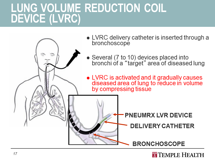 Lung Volume Reduction Coil Device (LVRC) - Activity One: Bronchoscopic ...