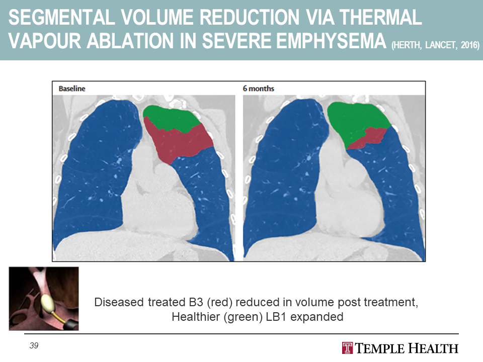 Temple Lung Center: Learning Center