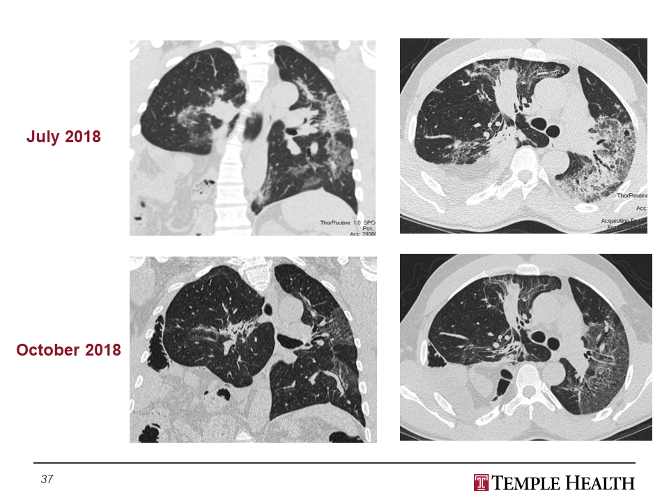 Temple Lung Center: Learning Center (No Video)