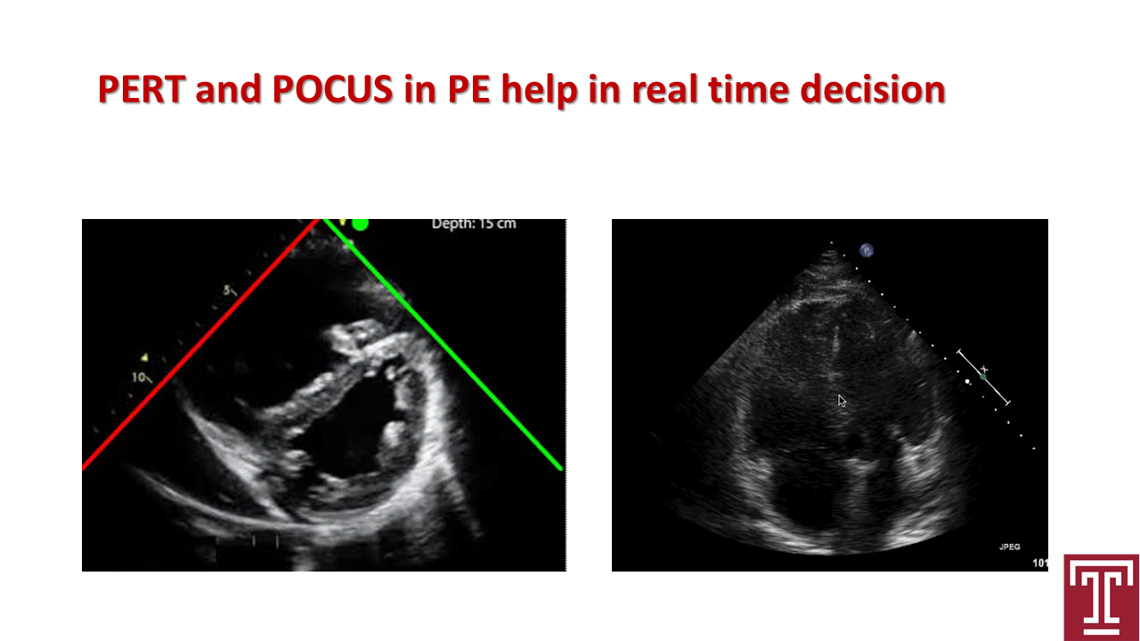 Temple Health Lung Center: Learning Center